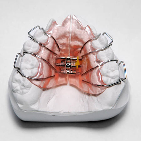 Dr. Salmeh Kalbassi - SPECIALIST IN ORTHODONTICS AND DENTOFACIAL ...